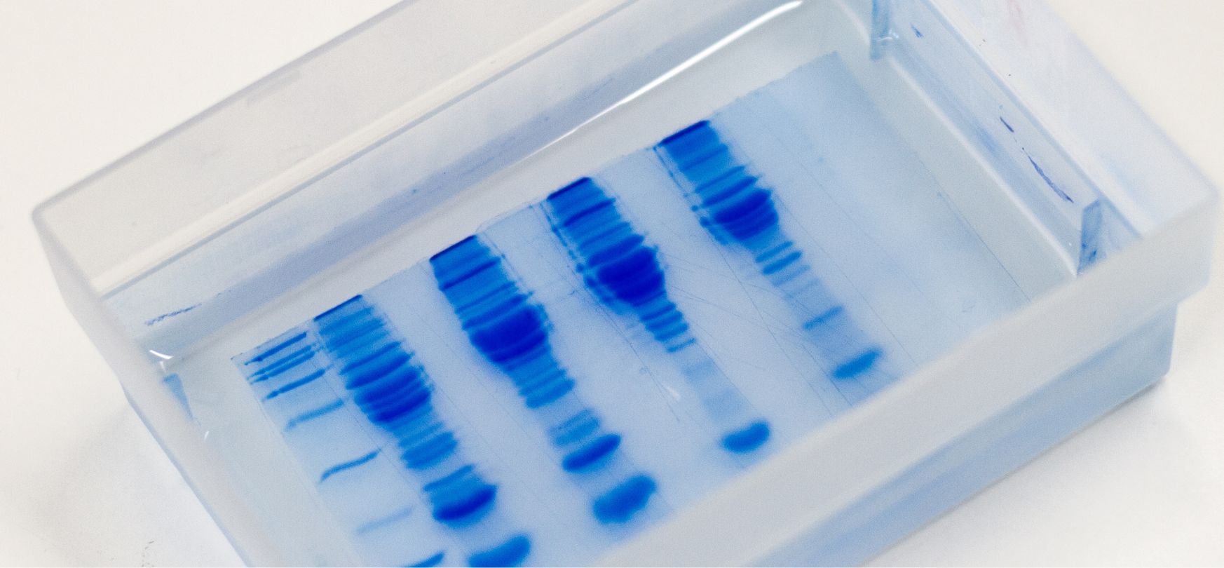 An Overview of Northern blot | GoldBio