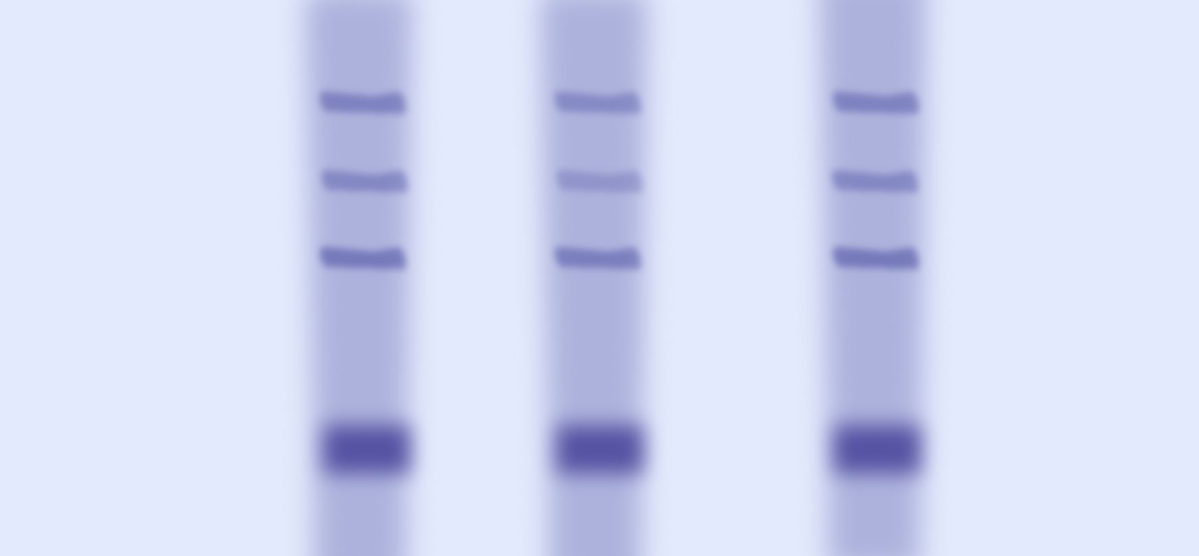 Introduction to Blotting Techniques in Molecular Biology | GoldBio