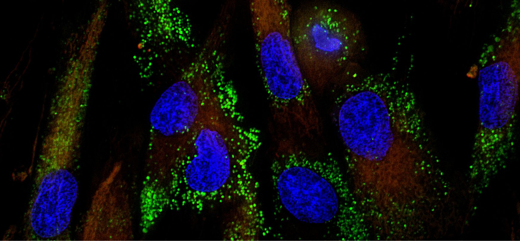 Fluorescence microscopy: A Basic Introduction | GoldBio